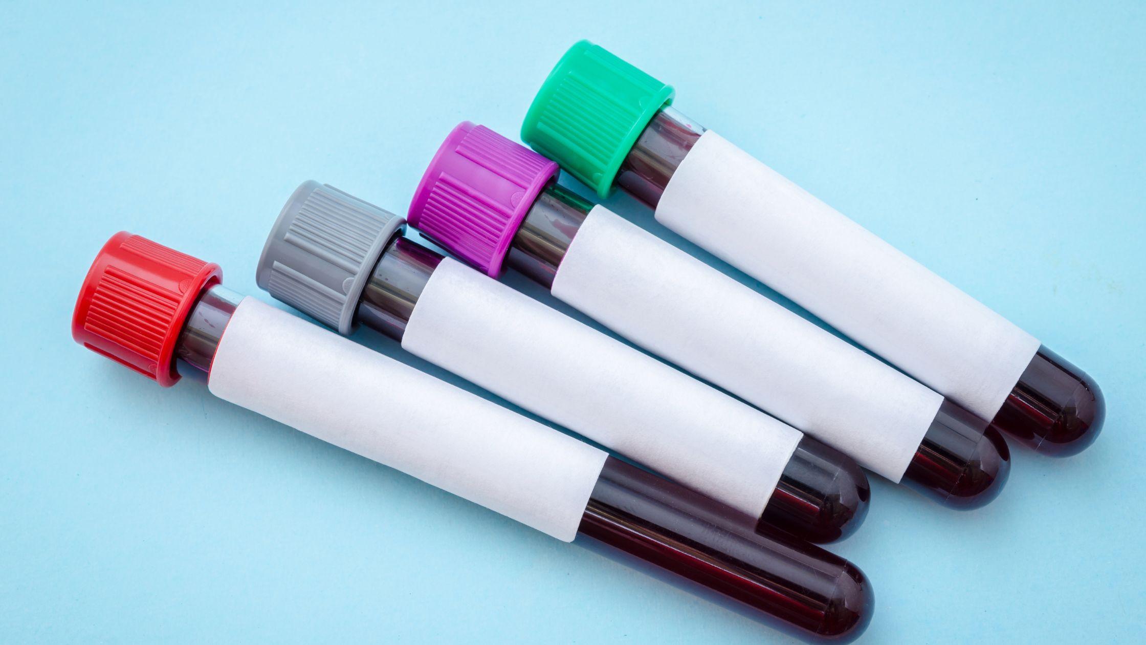 Comprehensive Buying Guide for Blood Collection Tubes - Medzell Guides Comprehensive Buying Guide for Blood Collection Tubes - Medzell Guides