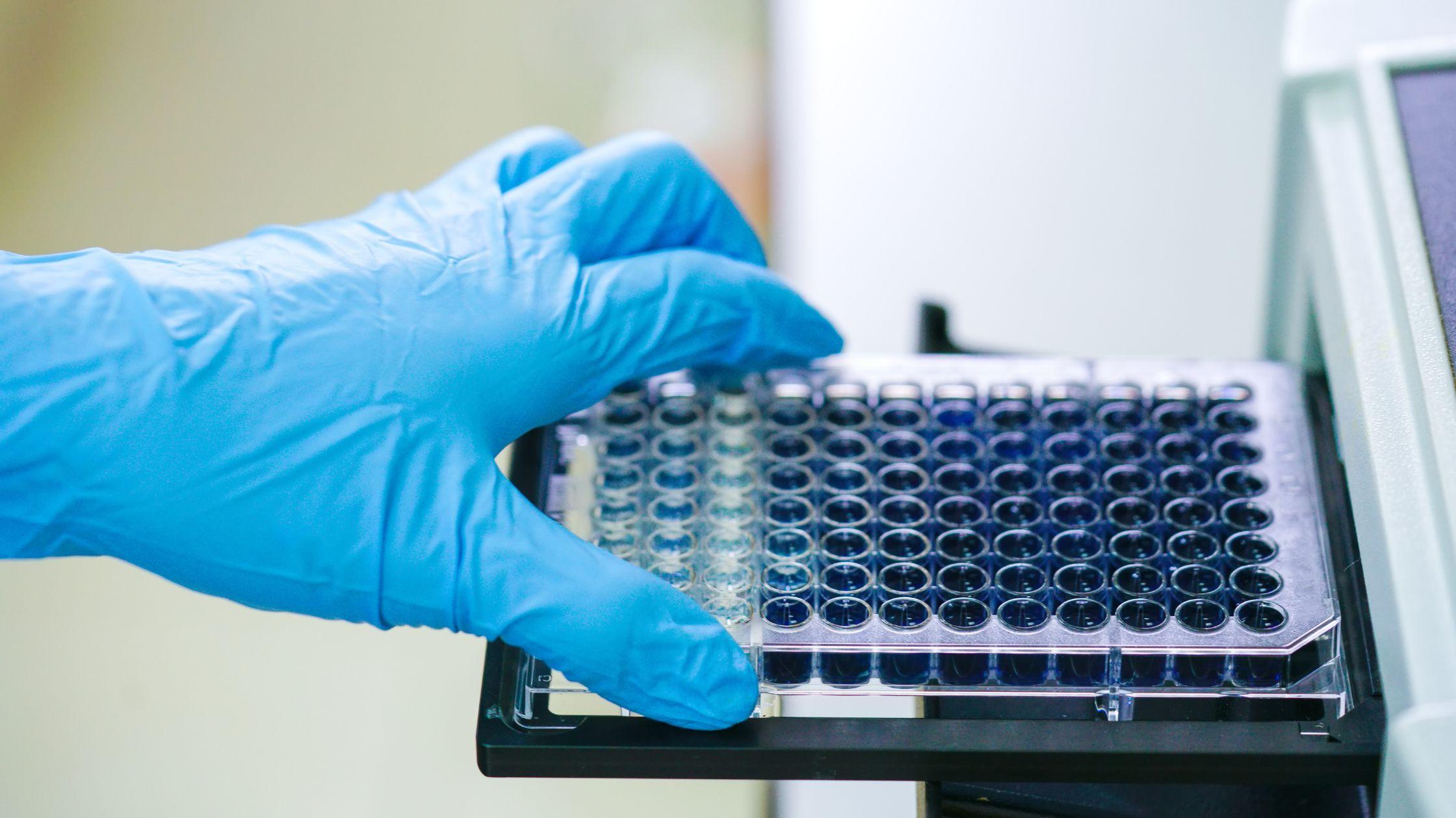 Mastering the Art of ELISA Plate Reader Selection: The Ultimate Buying ... Mastering the Art of ELISA Plate Reader Selection: The Ultimate Buying ...